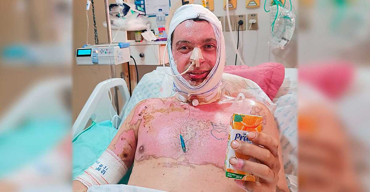 Jovem que teve rosto e tórax queimado aguarda nova cirurgia na traqueia ...